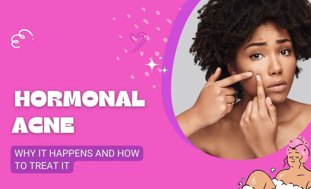 Hormonal Acne: Why It Happens and How to Treat It - Resurchify
