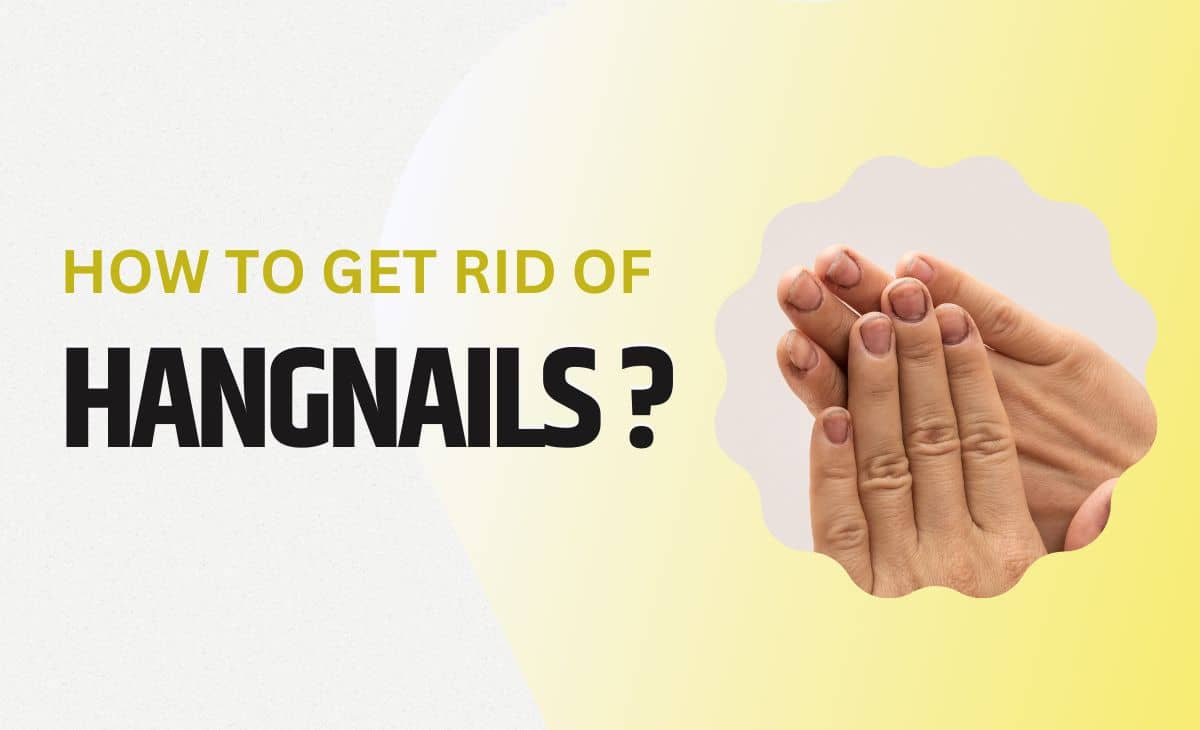 How To Get Rid Of Hangnails Resurchify