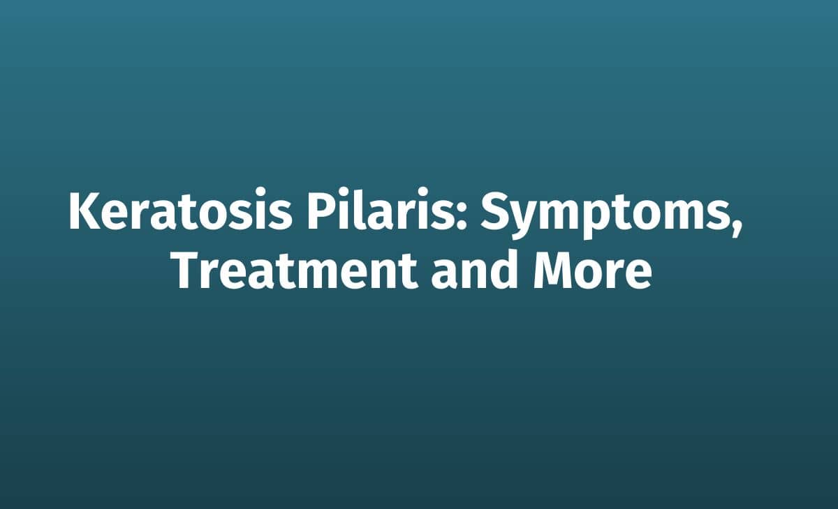 Keratosis Pilaris (Chicken Skin) - Resurchify
