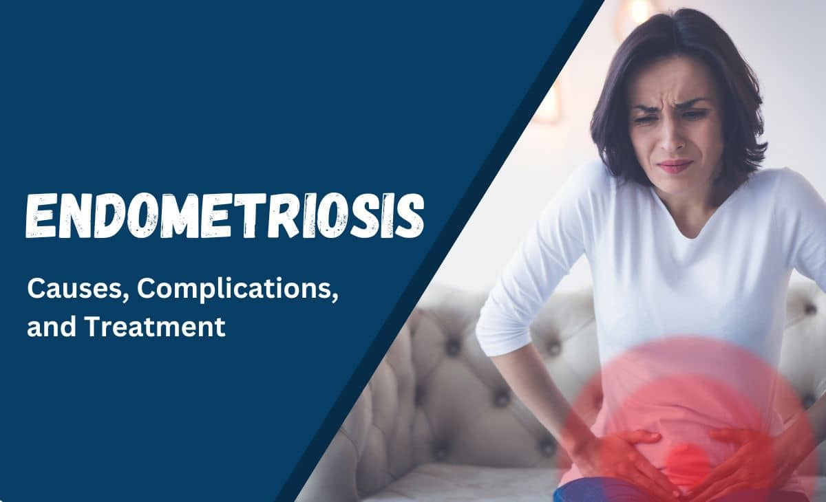 Endometriosis: Causes, Complications, and Treatment - Resurchify Endometriosis: Causes, Complications, and Treatment - Resurchify